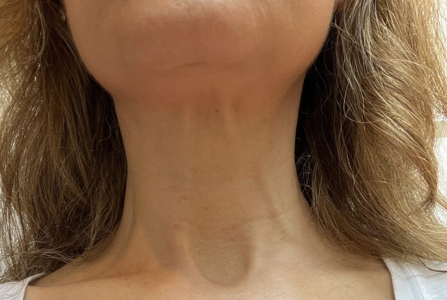 Exercises to tackle double chin and loose neck skin - Honest Voice