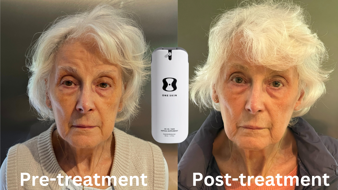 OneSkin Review: Topical face, eye, hair & body supplements + SPF with a ...